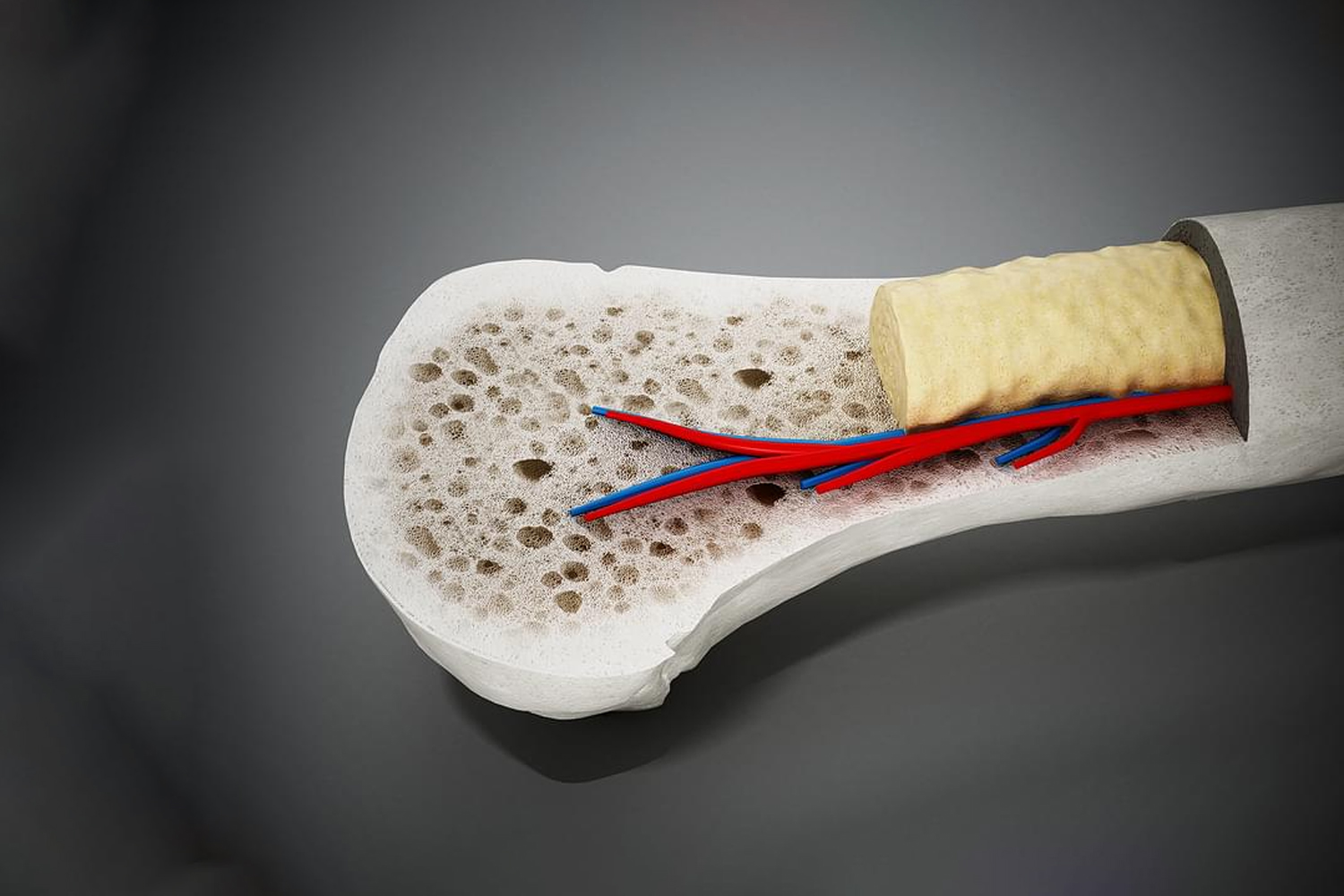 Stem Cell & Bone Marrow Transplant Failure Syndrome – The Cell